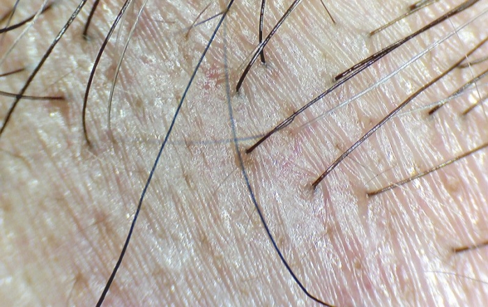 DE 330T Digital Trichoscope - Firefly Global