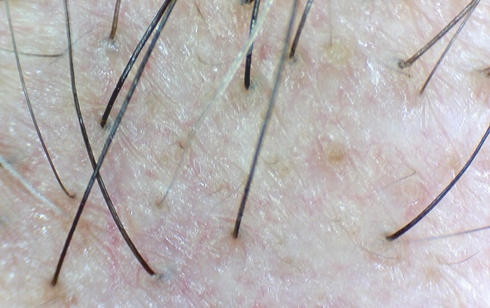 DE 330T Digital Trichoscope - Firefly Global