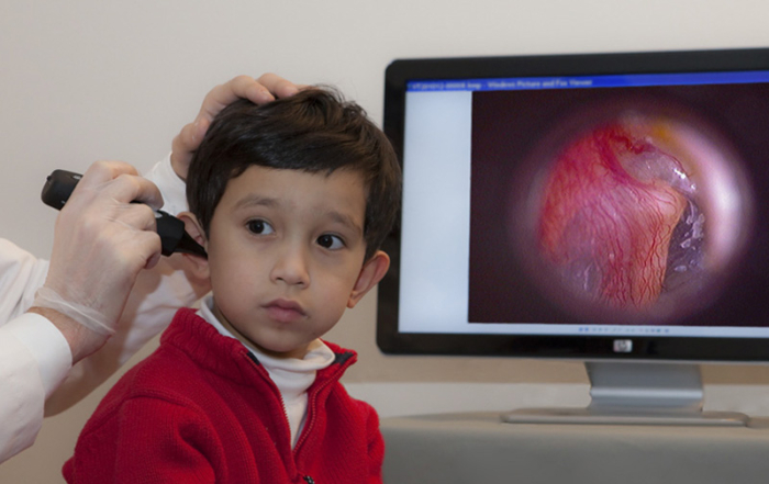 Wireless Video Otoscope - Firefly Global